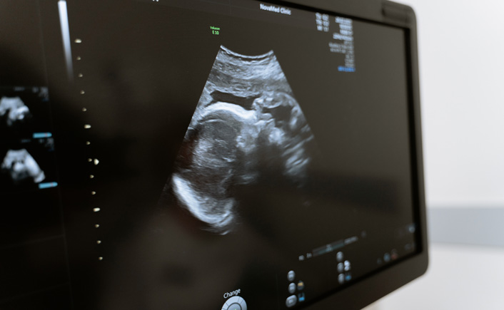 Does an Unborn Baby Have a Soul with Rights? - Eternal Perspective ...